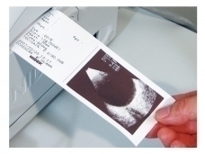 B Scan | B Scan Eye Test | Best Eye Hospital in Pakistan