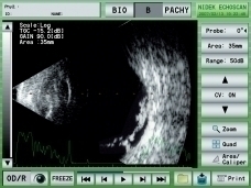 B Scan | B Scan Eye Test | Best Eye Hospital in Pakistan